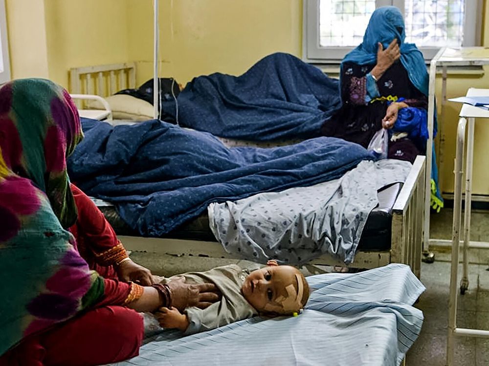 Афганистанд үл мэдэгдэх аюулт өвчин дэгджээ